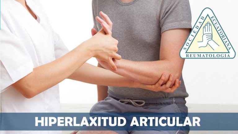 Hiperlaxitud articular: Qué es, síntomas y tratamientos de las ...